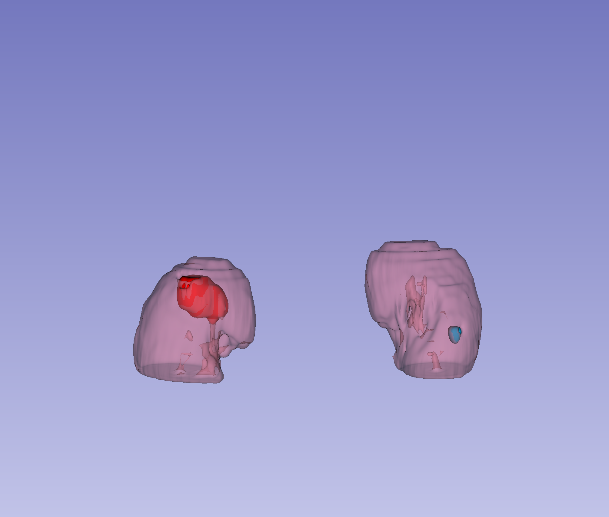 MHub - The New Deployment Standard for Medical Imaging AI