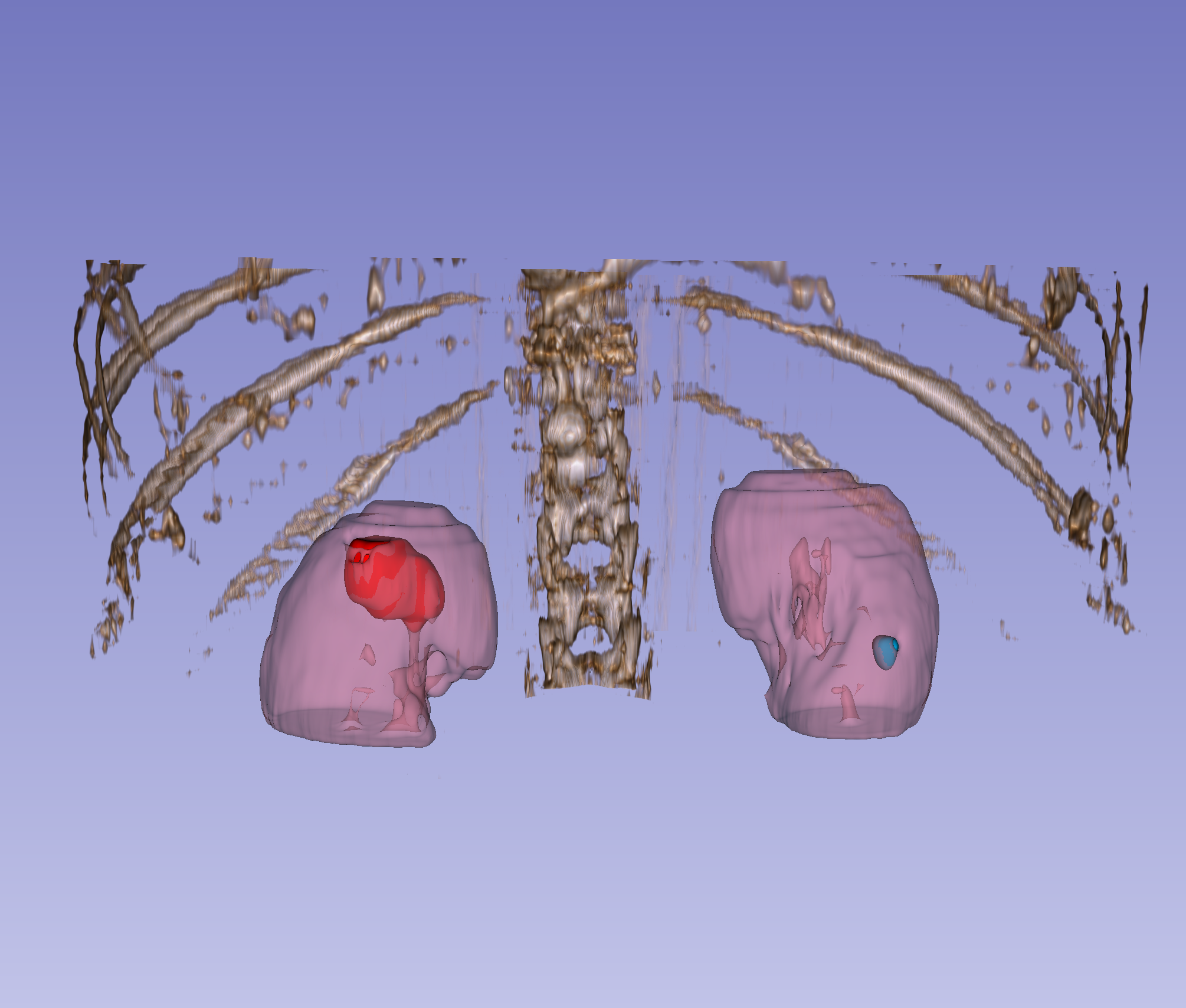 MHub - The New Deployment Standard for Medical Imaging AI