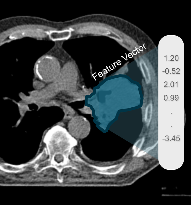 MHub - The New Deployment Standard for Medical Imaging AI