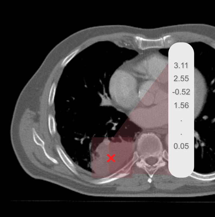 MHub - The New Deployment Standard for Medical Imaging AI