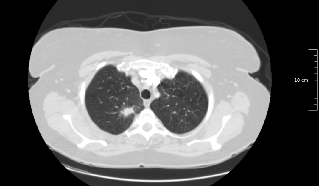 MHub - The New Deployment Standard for Medical Imaging AI