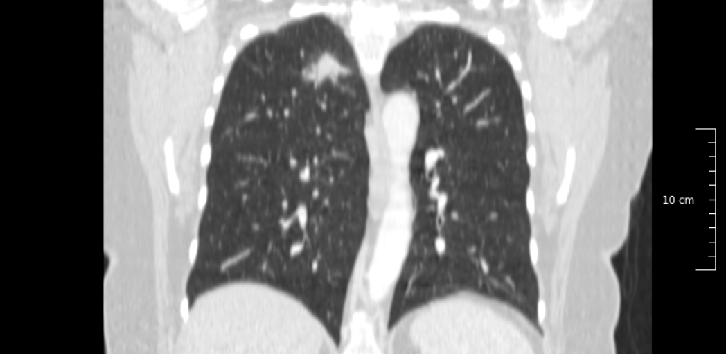 MHub - The New Deployment Standard for Medical Imaging AI