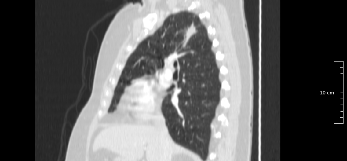 MHub - The New Deployment Standard for Medical Imaging AI
