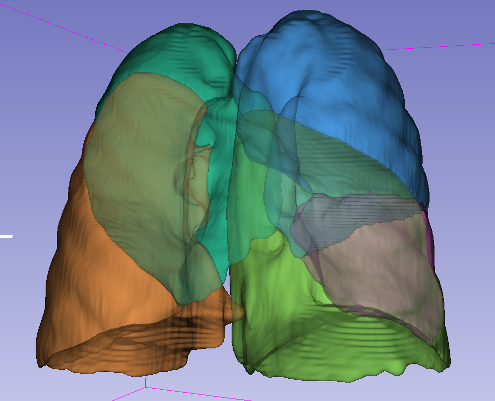 MHub - The New Deployment Standard for Medical Imaging AI