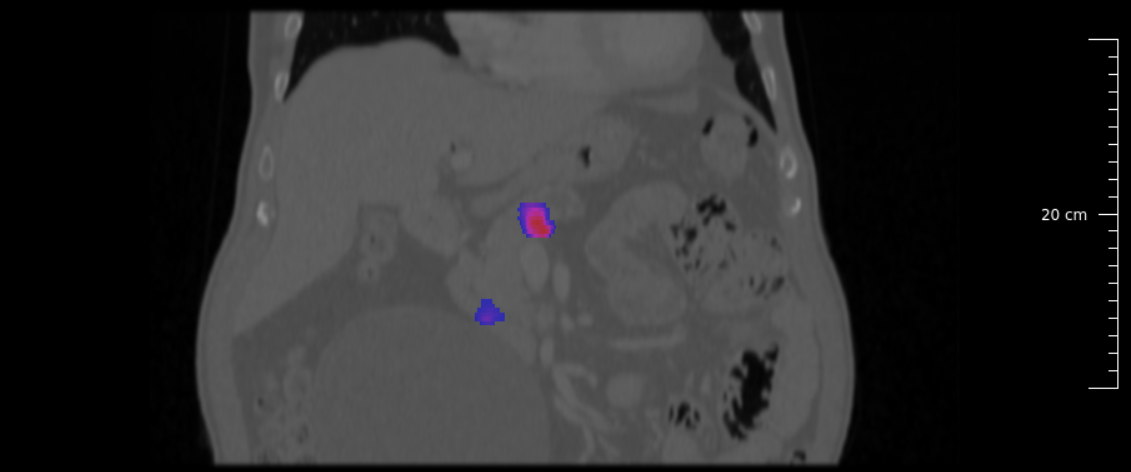 MHub - The New Deployment Standard for Medical Imaging AI