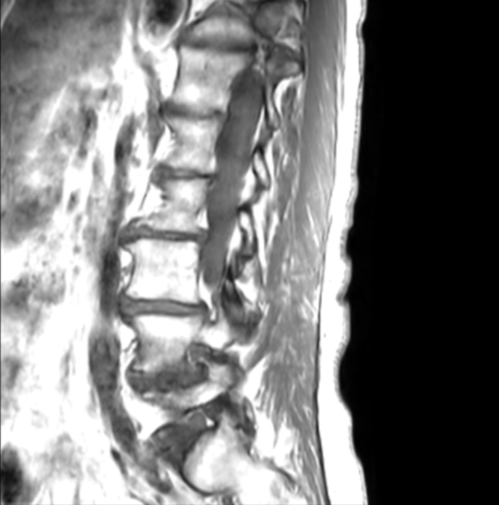 MHub - The New Deployment Standard for Medical Imaging AI