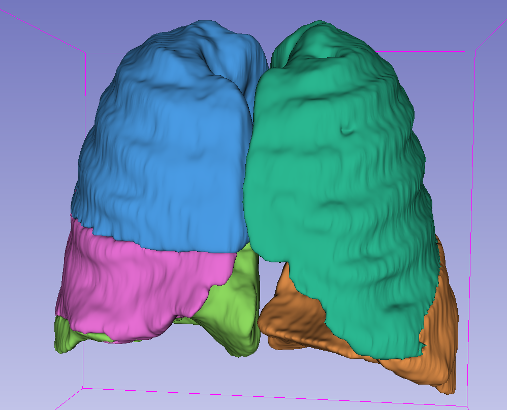MHub - The New Deployment Standard for Medical Imaging AI