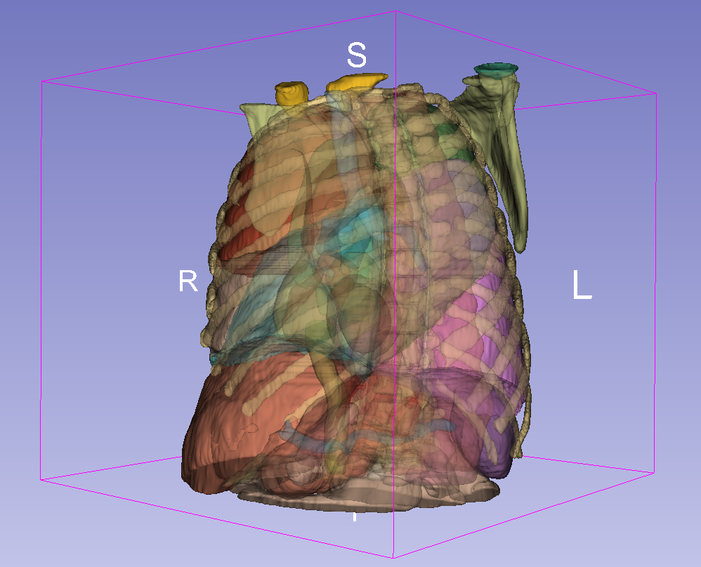 MHub - The New Deployment Standard for Medical Imaging AI